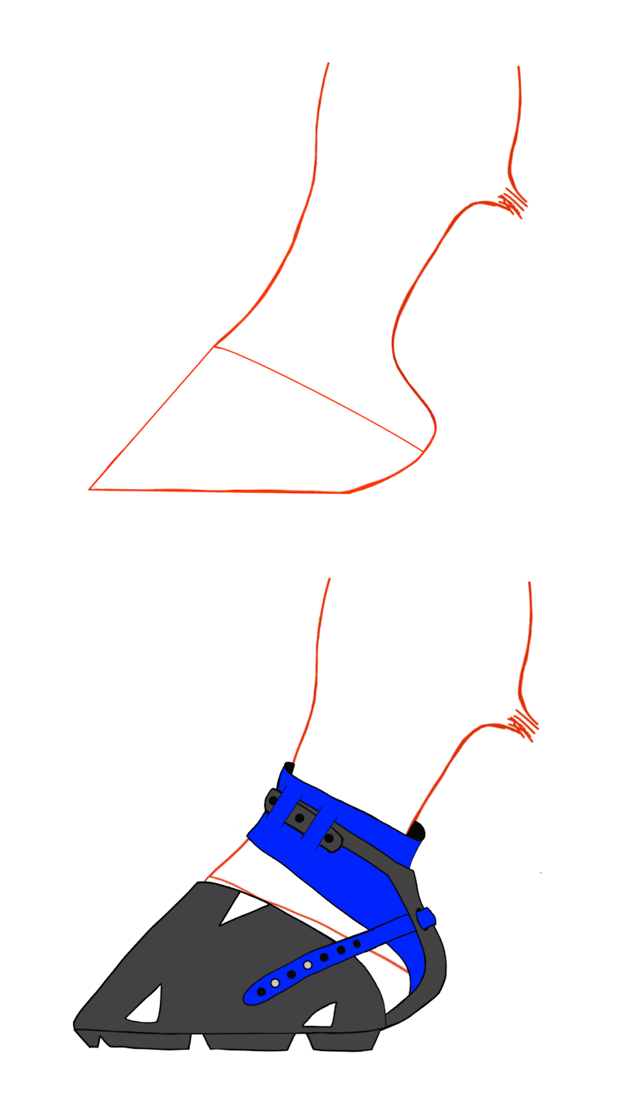 Understanding Underrun Heels: What They Are and What to Do About Them ...